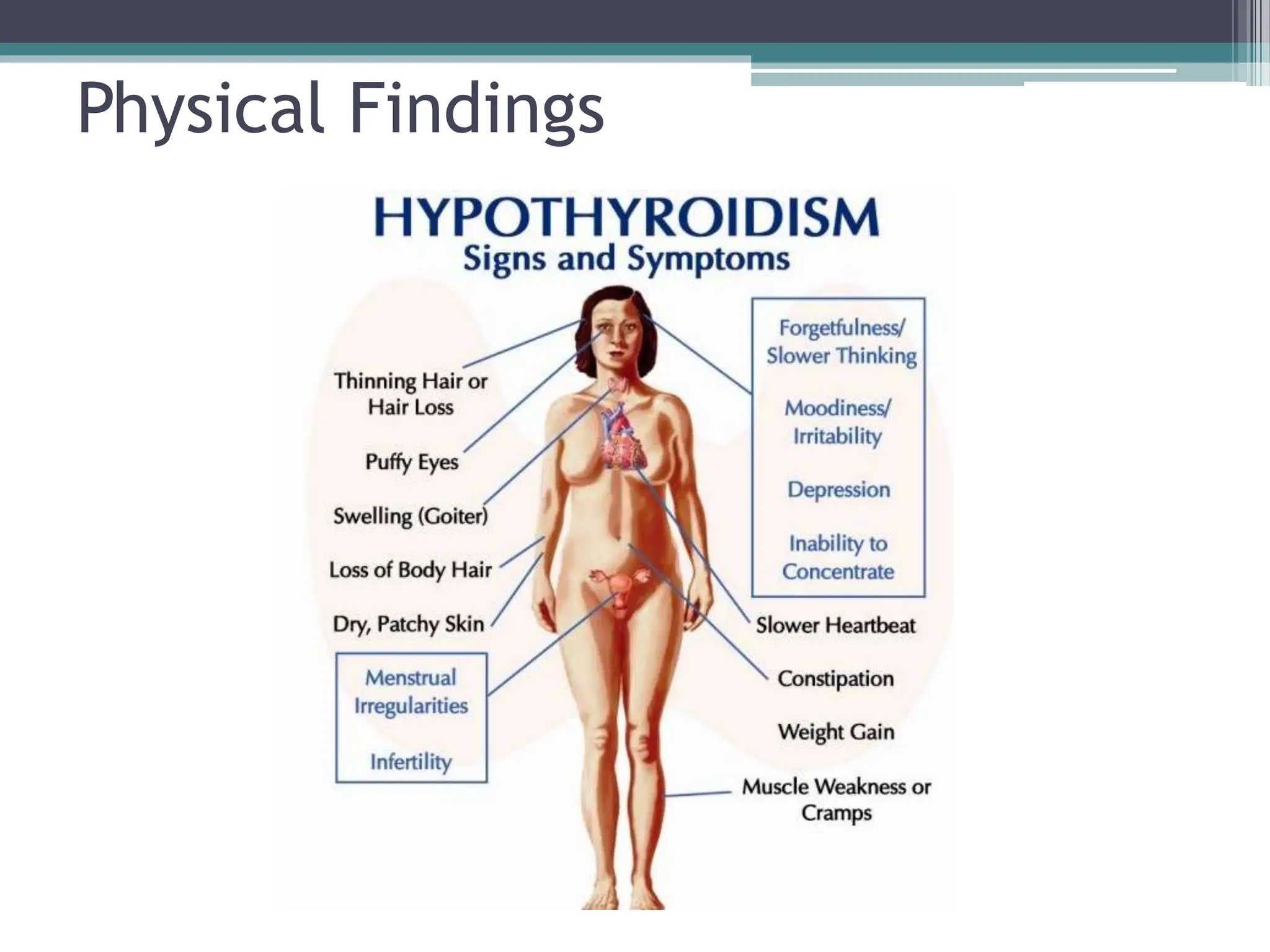 Guidelines for the Treatment of Hypothyroidism.pptx