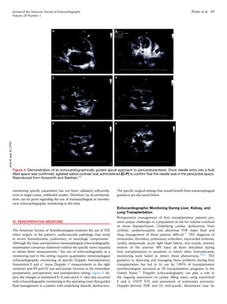 Guidelines for the use of echocardiography as a monitor for therapeutic ...