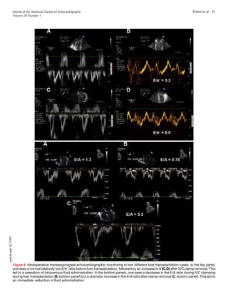 Guidelines for the use of echocardiography as a monitor for therapeutic ...
