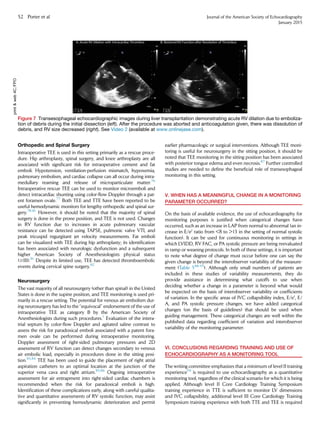 Guidelines for the use of echocardiography as a monitor for therapeutic ...
