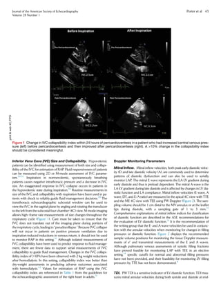 Guidelines for the use of echocardiography as a monitor for therapeutic ...