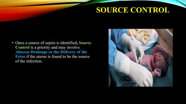 Guidelines & Identification of Early Sepsis DR. NN CHAVAN 02122023.pptx