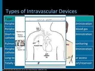 Guideline Update For The Management Of Intravenous Catheter Related ...