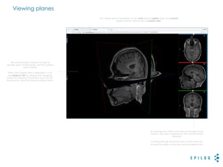 Guideline viewer interpretation | PPT
