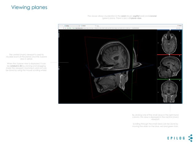 Guideline viewer interpretation | PPT