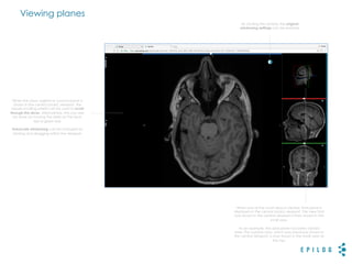 Guideline viewer interpretation | PPT
