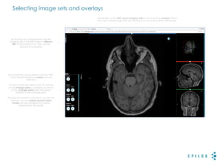 Guideline viewer interpretation | PPT