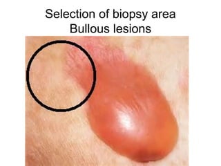 Guide on skin biopsy. Mikhail Valivach | PPT