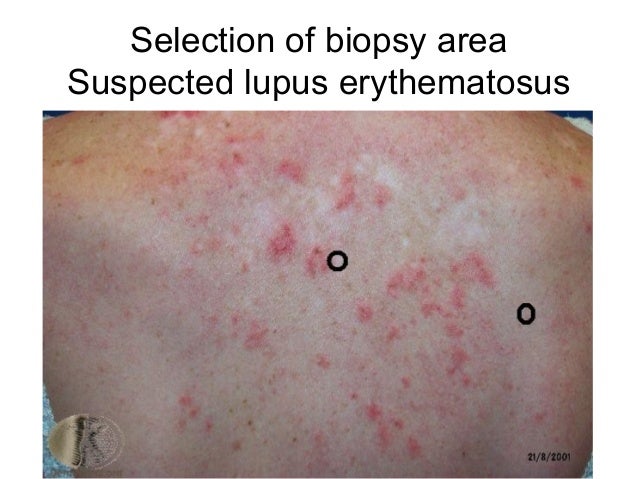 Guide on skin biopsy. Mikhail Valivach