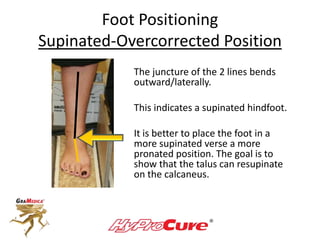 Neutral and Relaxed Stance X-ray Positioning for TaloTarsal Joint ...