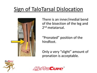 Neutral and Relaxed Stance X-ray Positioning for TaloTarsal Joint ...
