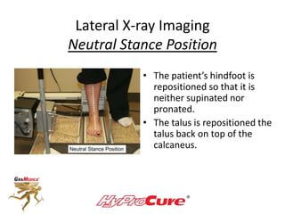 Neutral and Relaxed Stance X-ray Positioning for TaloTarsal Joint ...