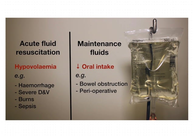 IV FLUIDS -Easy | PPT