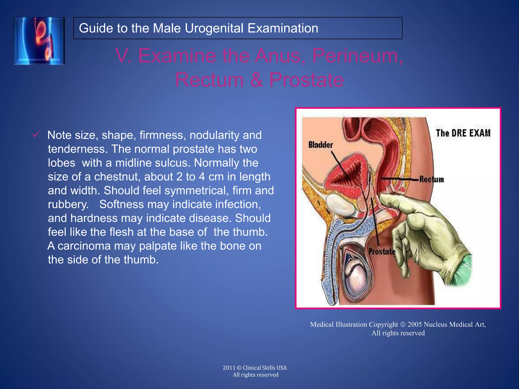 A Guide to the Clinical Male Urogenital Examination | PPTX