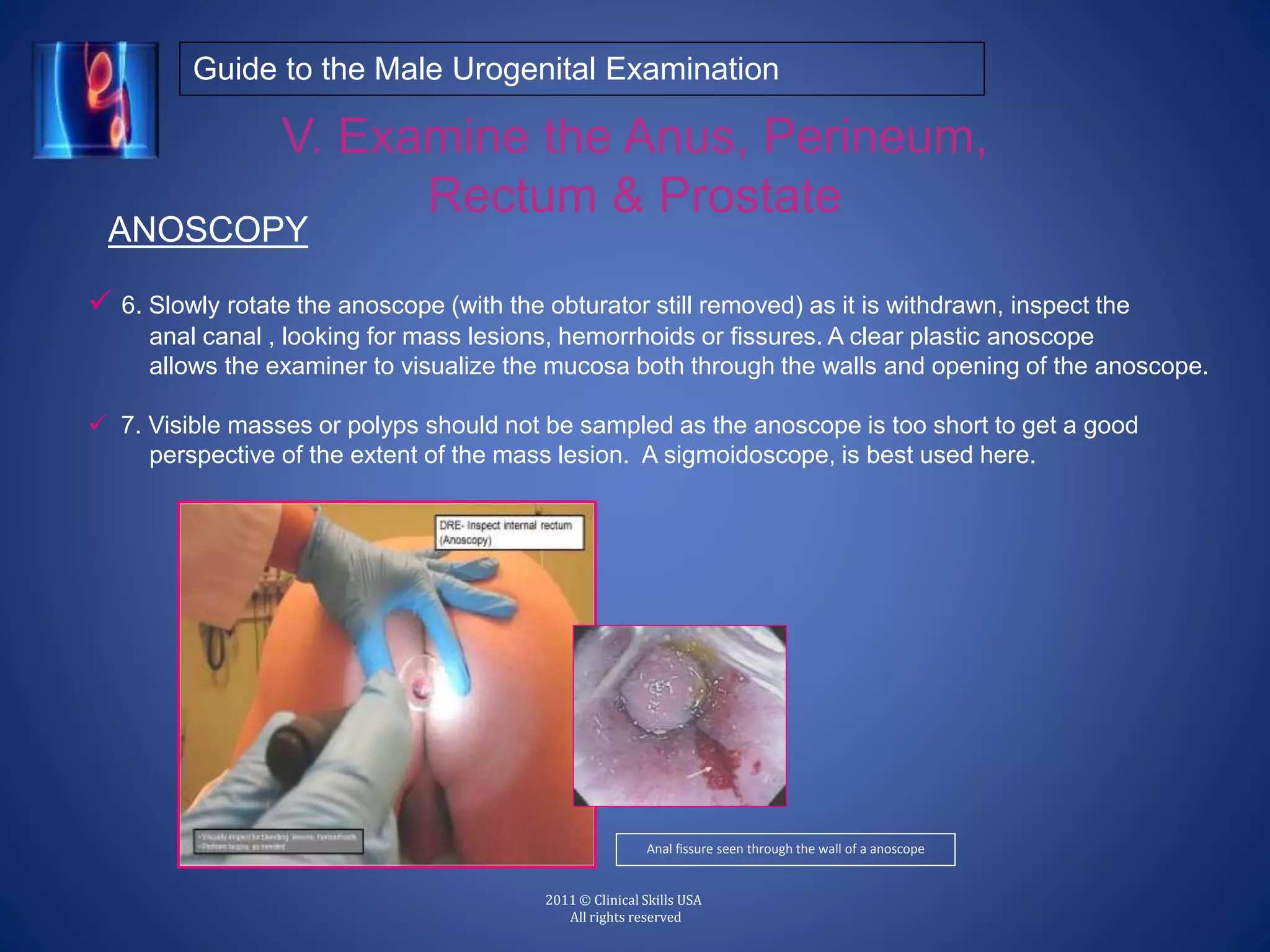 A Guide to the Clinical Male Urogenital Examination | PPTX