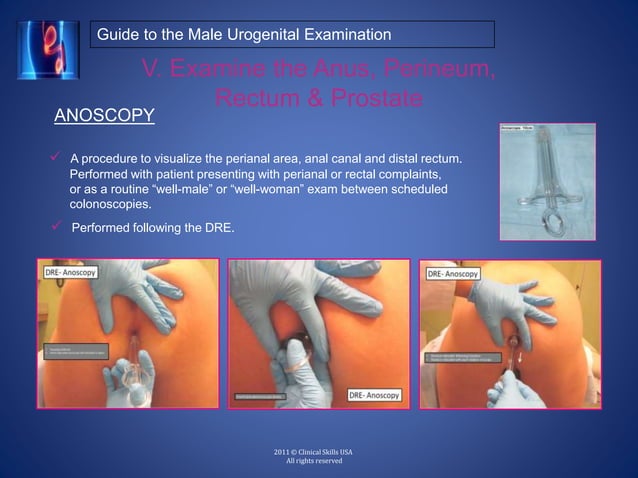 A Guide to the Clinical Male Urogenital Examination | PPTX | Sexual Conditions | Sexual Health