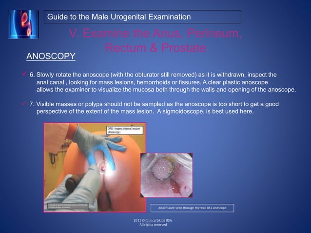 A Guide to the Clinical Male Urogenital Examination | PPTX | Sexual ...