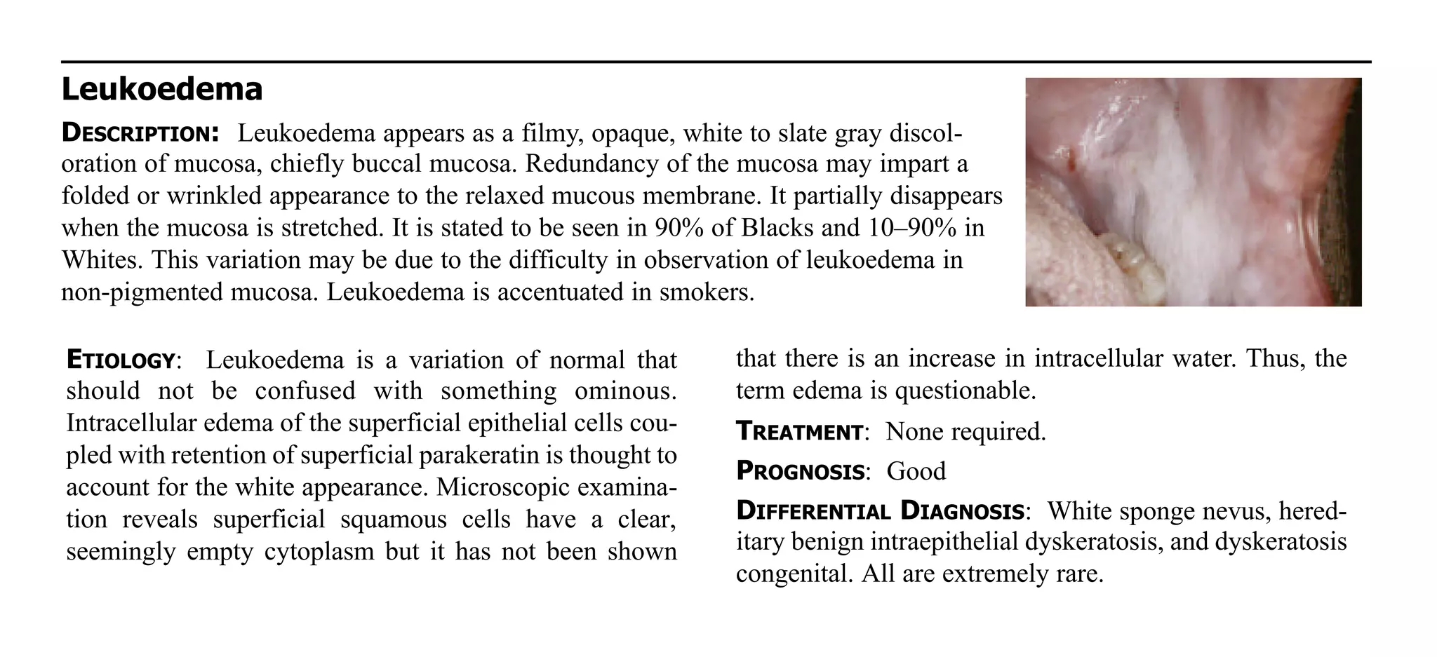 Guide to oral lesions | PDF