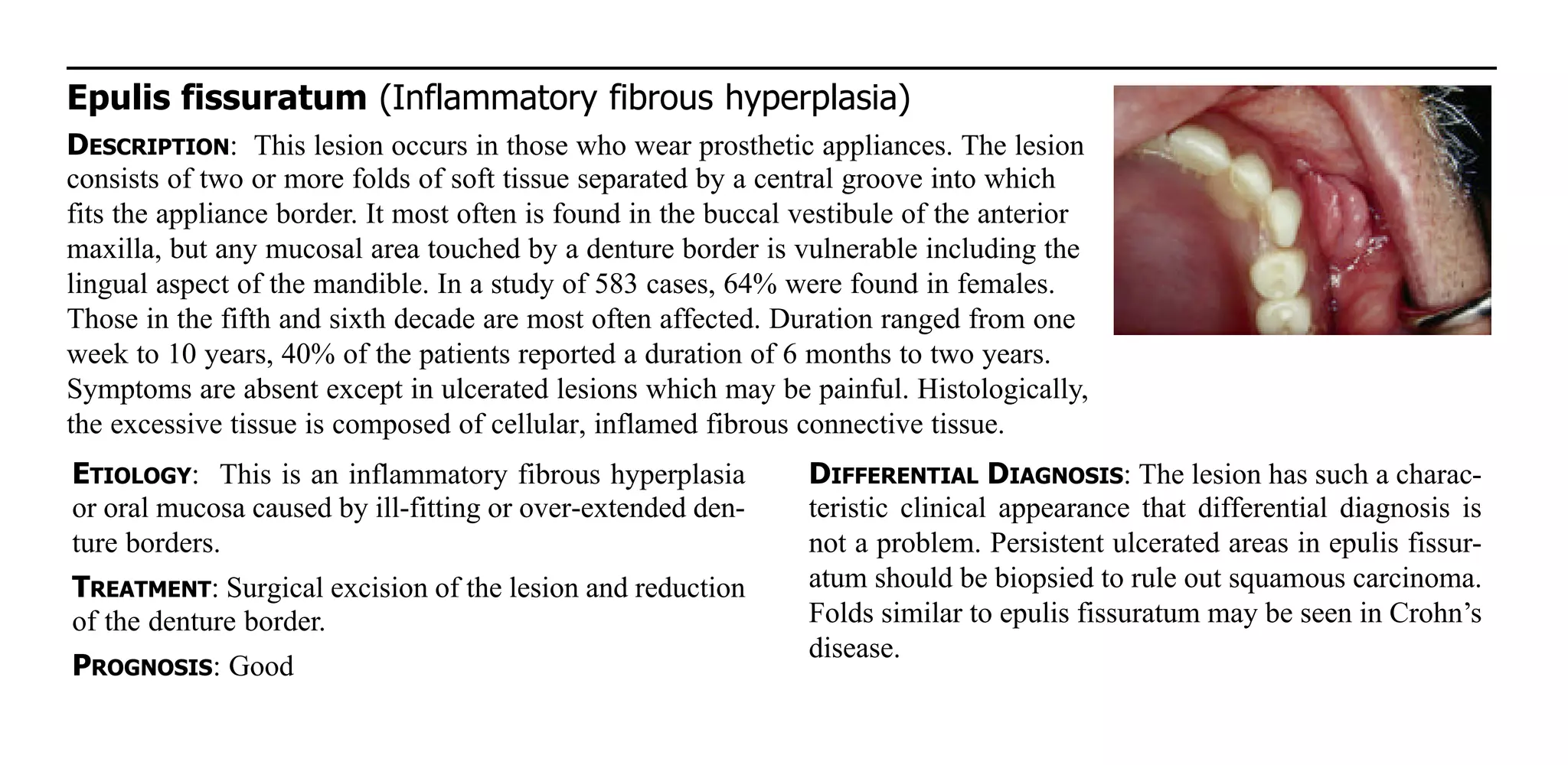 Guide to oral lesions | PDF