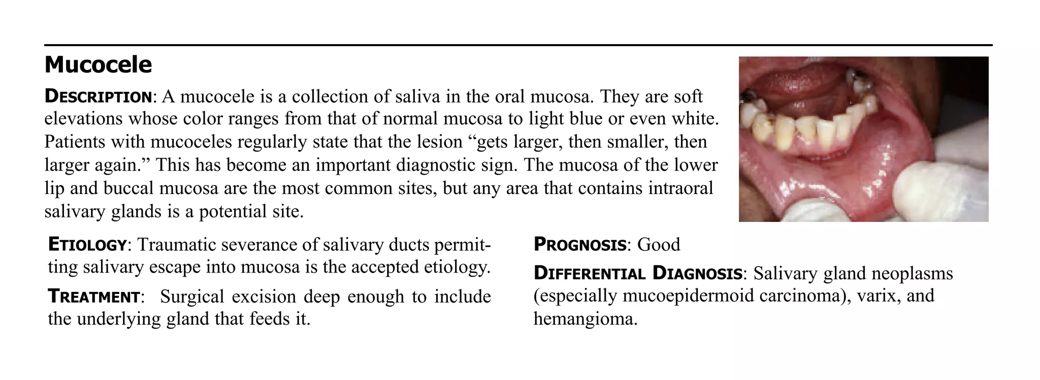 Guide to oral lesions | PDF