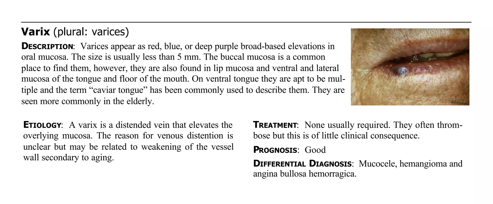 Guide to oral lesions | PDF