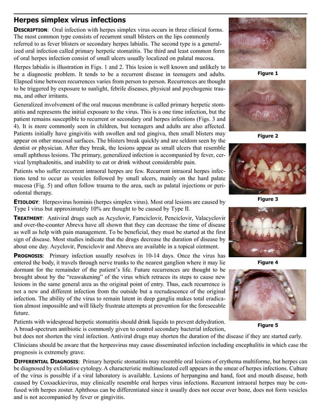 Guide to oral lesions | PDF