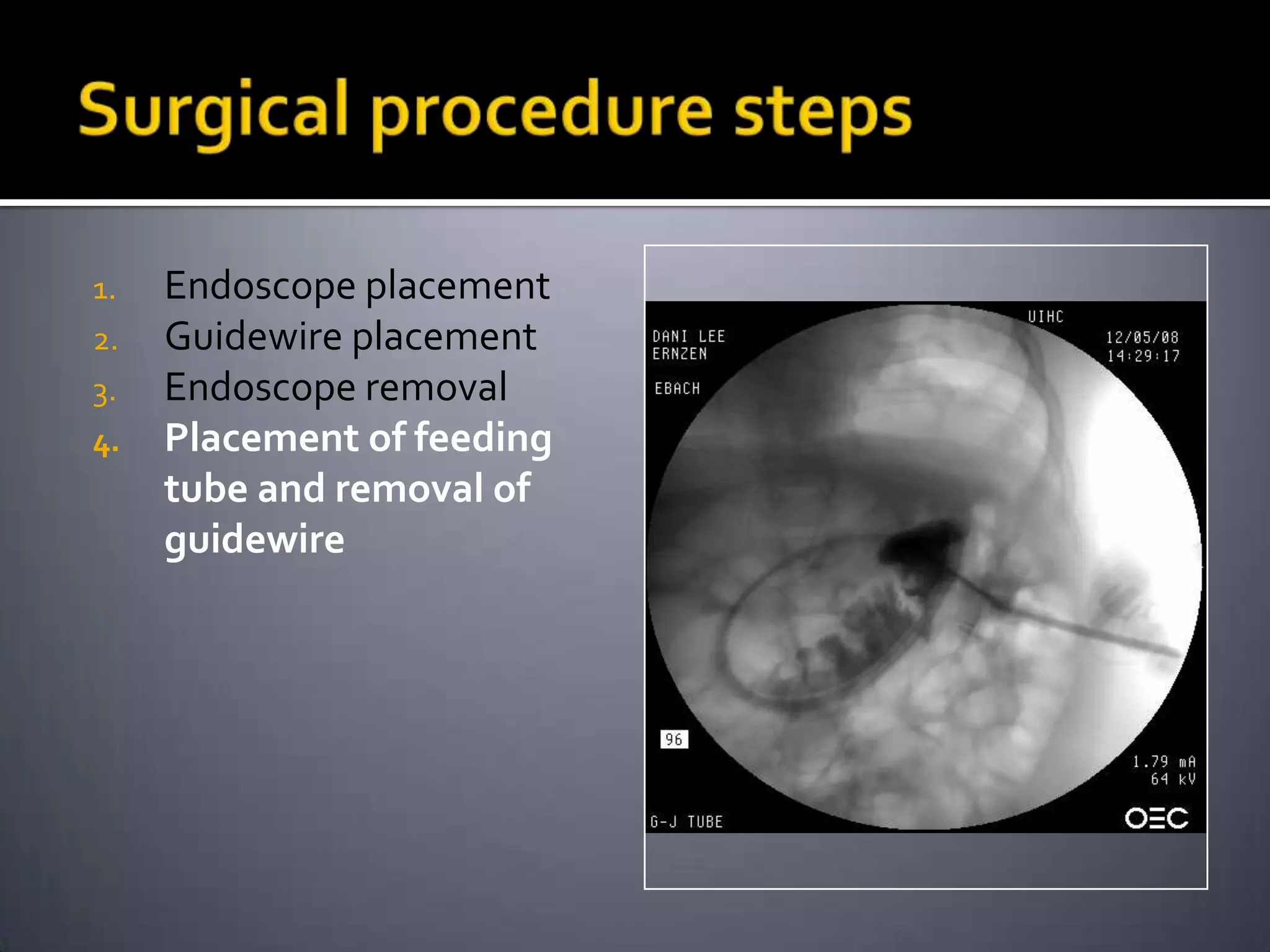Guidewire Final Presentation Apr 12 | PPTX