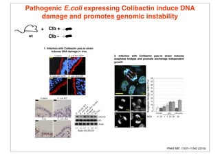 Bacteria & Cancer | PPT