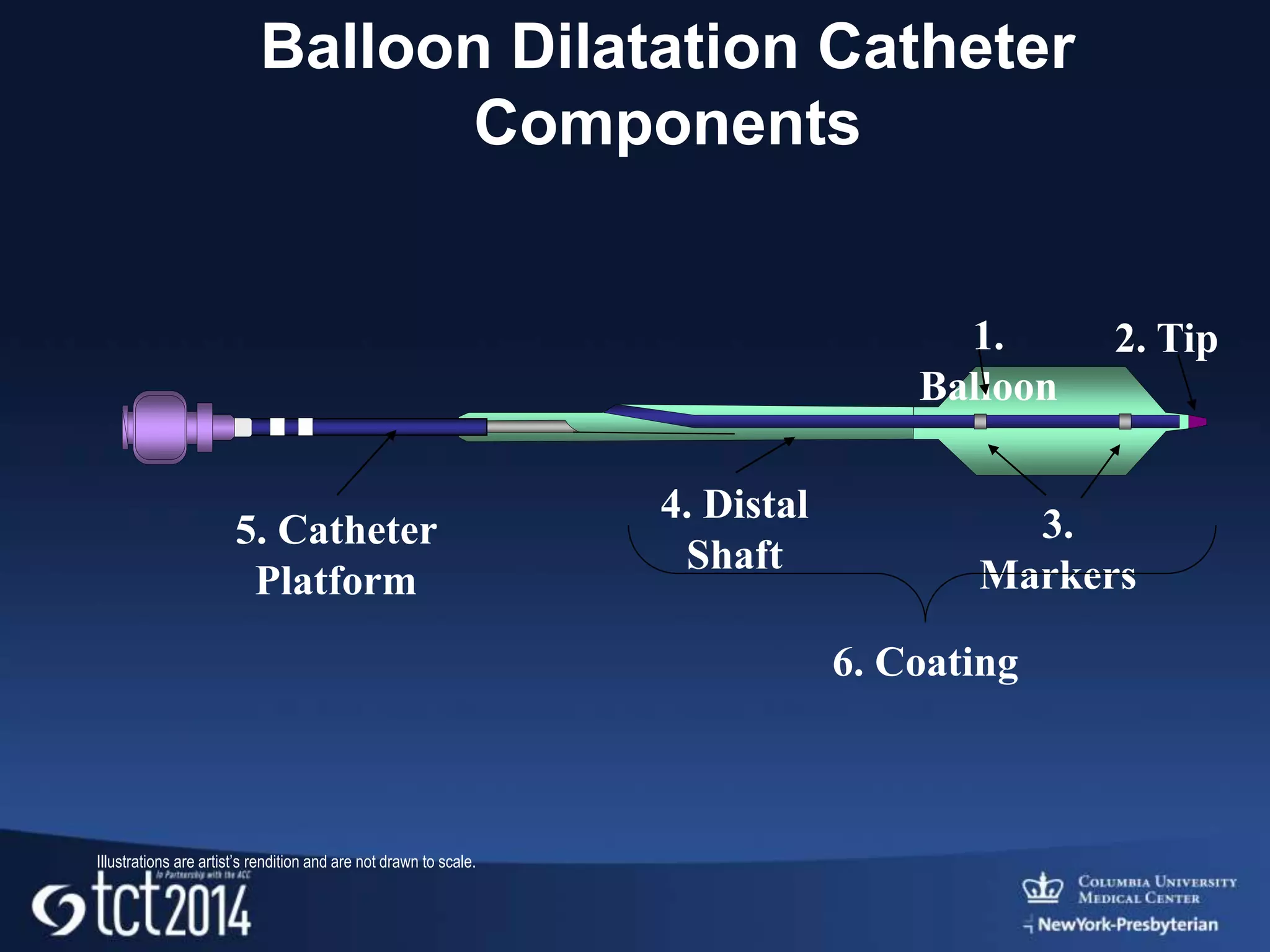 interventional cardiology, Guiding catheters, wires, and balloons ...