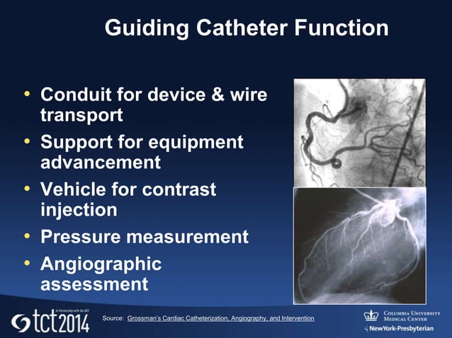 interventional cardiology, Guiding catheters, wires, and balloons ...