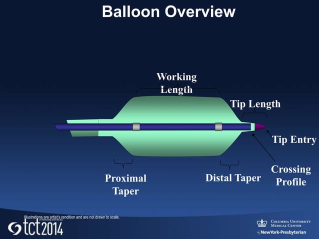 interventional cardiology, Guiding catheters, wires, and balloons ...