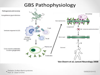Guillain - Barré syndrome | PPT