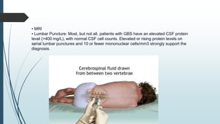 Guillain barré syndrome (GBS) | PPTX