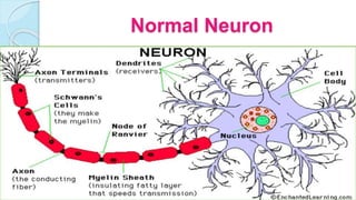 Guillain barré syndrome | PPTX