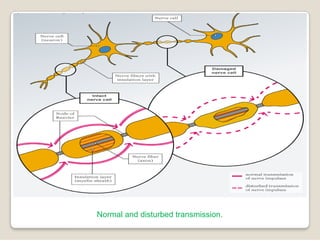 Guillain Barre syndrome (GBS) .pdf