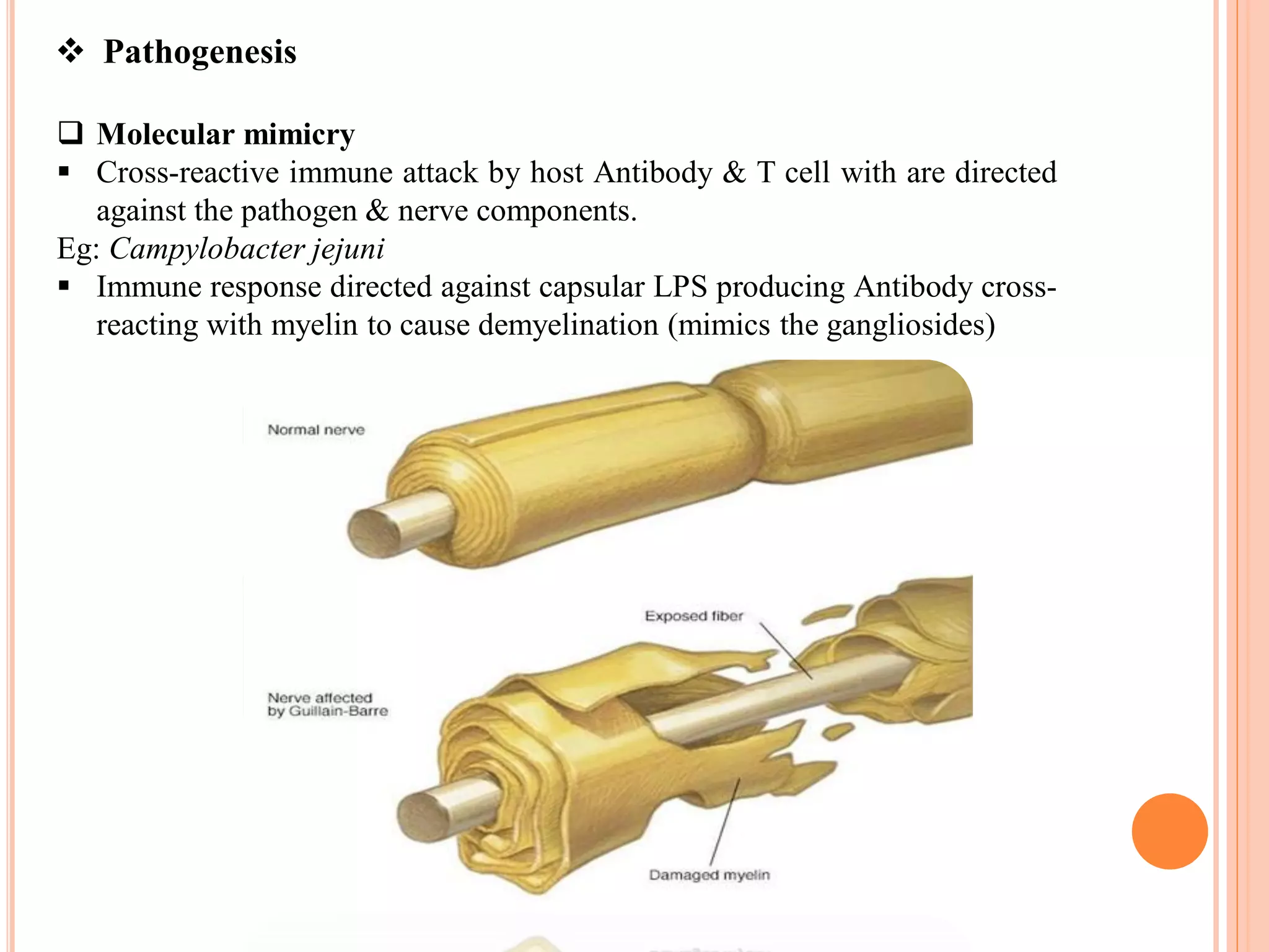 Guillain Barre Syndrome (GBS) | PDF