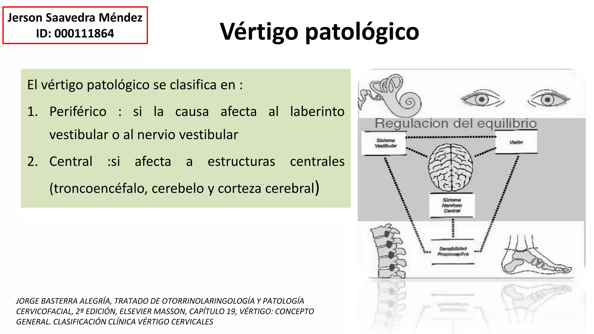 Guillermo fonseca sindrome vertiginoso | PPT
