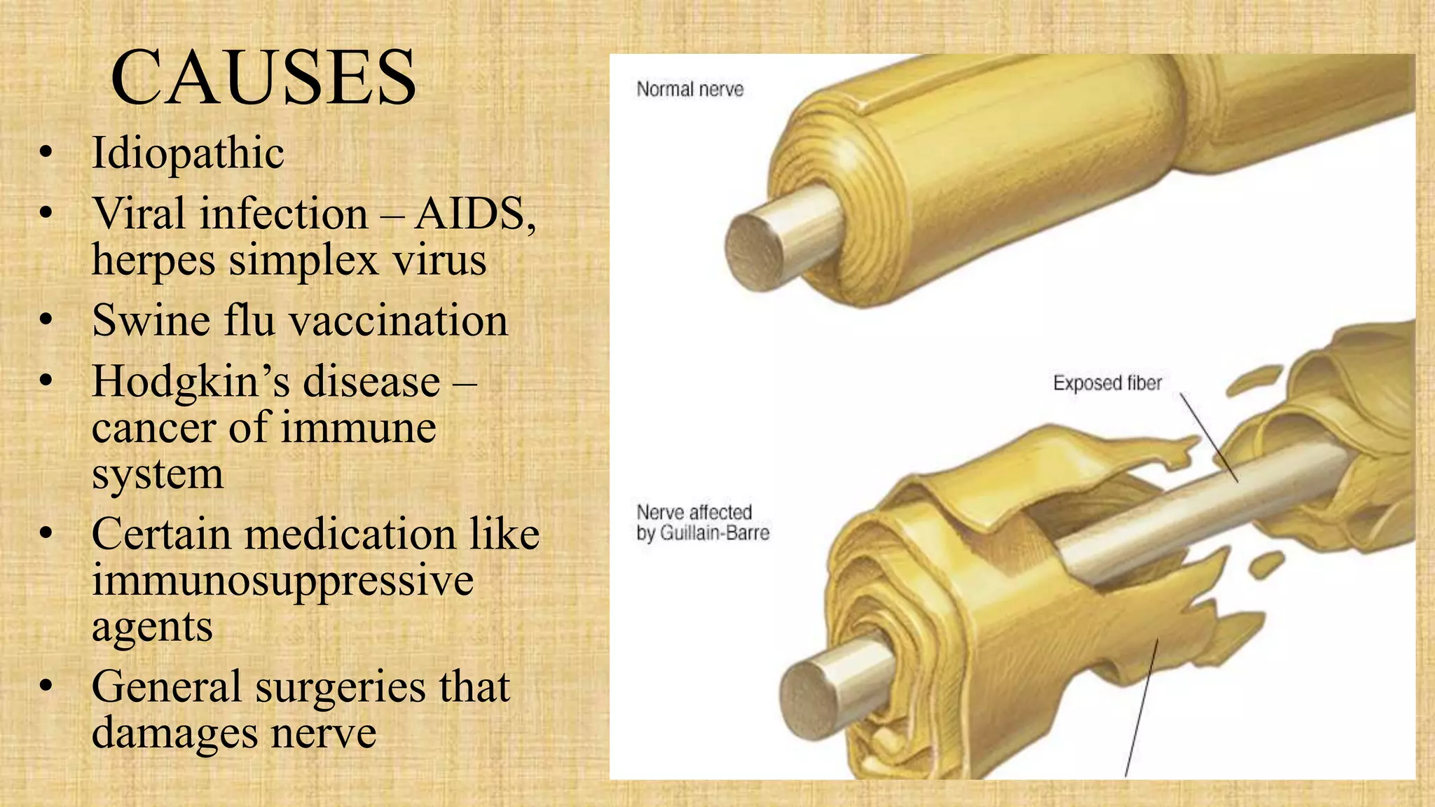 Guillian barre syndrome | PPTX
