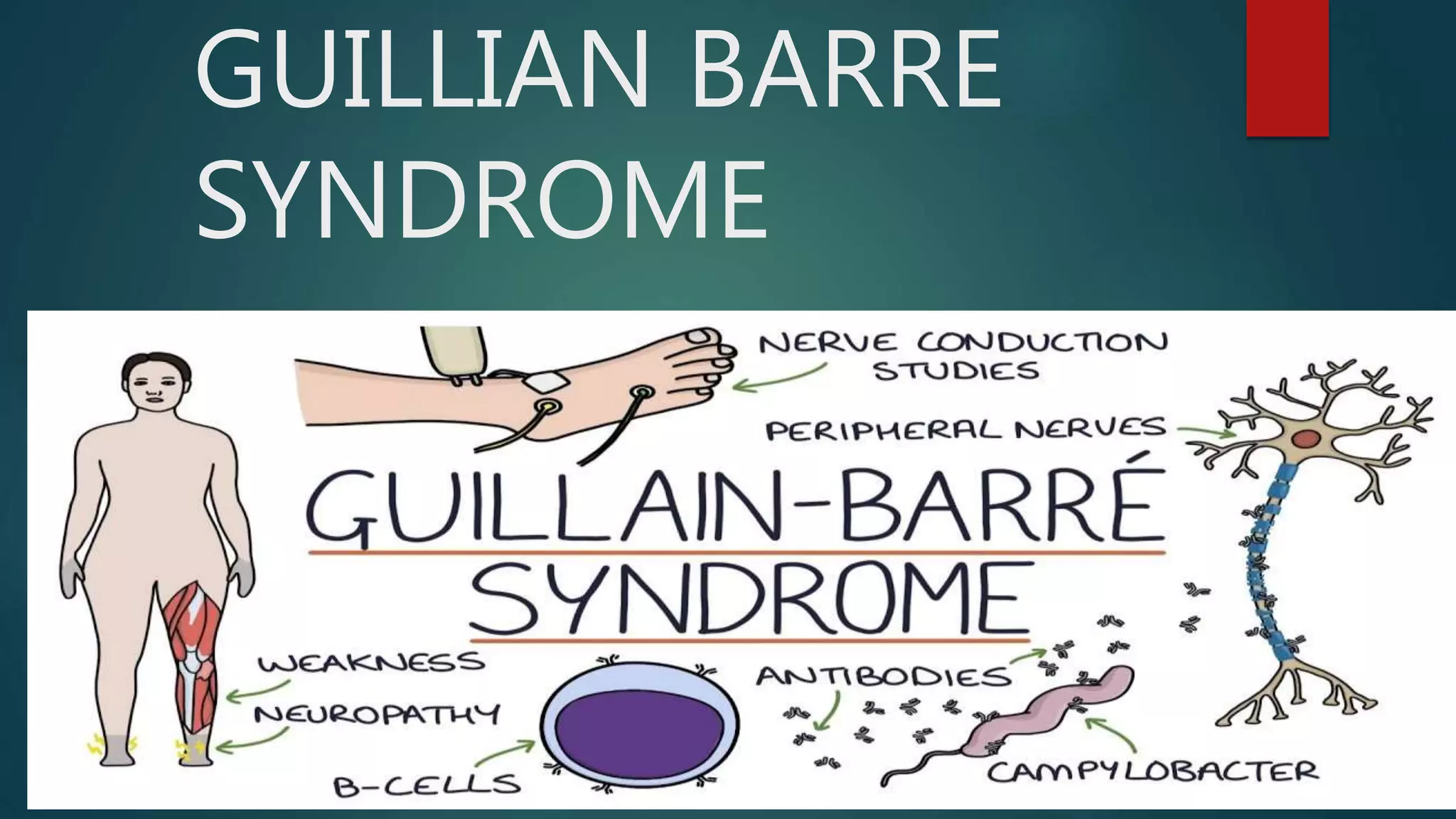 GUILLIAN BARRE SYNDROME.pptx