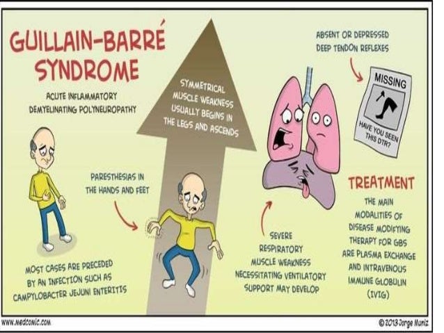 Guillen barre syndrome