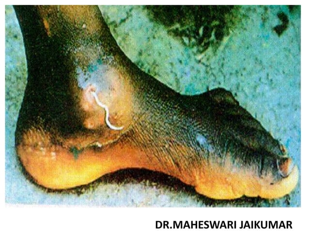 GUINEA CONTROL PROGRAMME - INDIA | PPTX