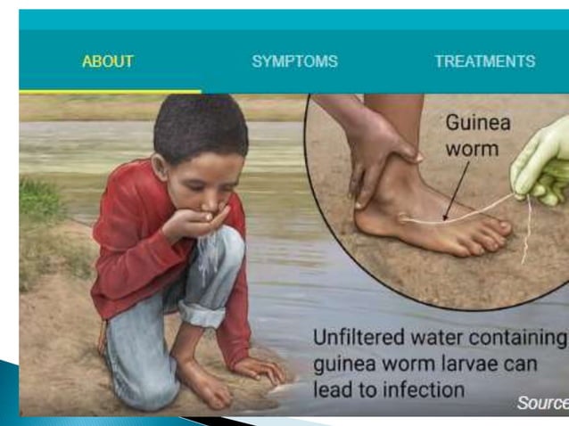 Guinea worm & yaws eradication programme | PPTX | Infectious Diseases ...
