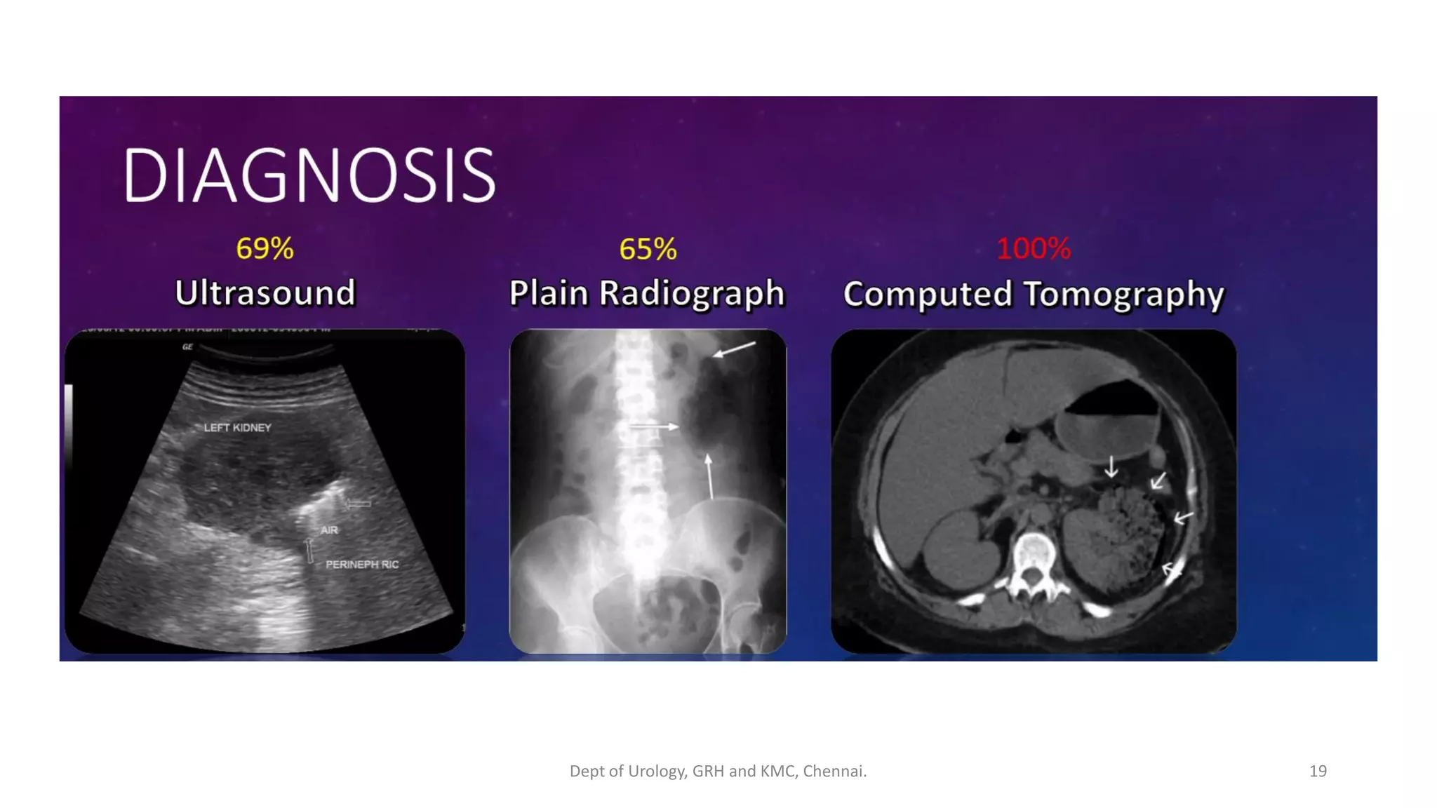 EMPHYSEMATOUS PYELONEPHRITIS | PDF