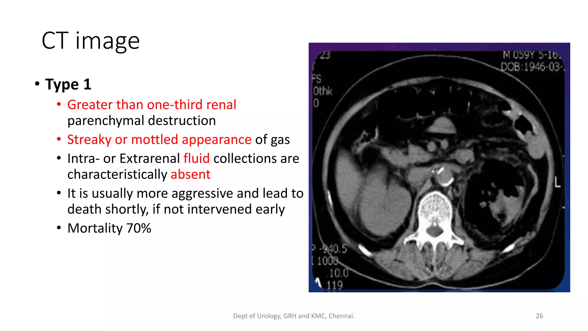 EMPHYSEMATOUS PYELONEPHRITIS | PDF