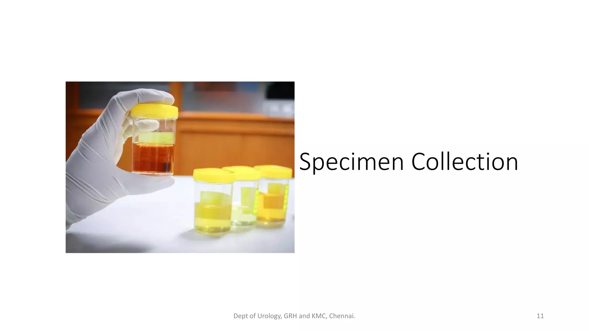 URINE ANALYSIS | PPT