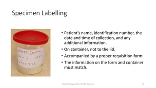 URINE ANALYSIS | PDF