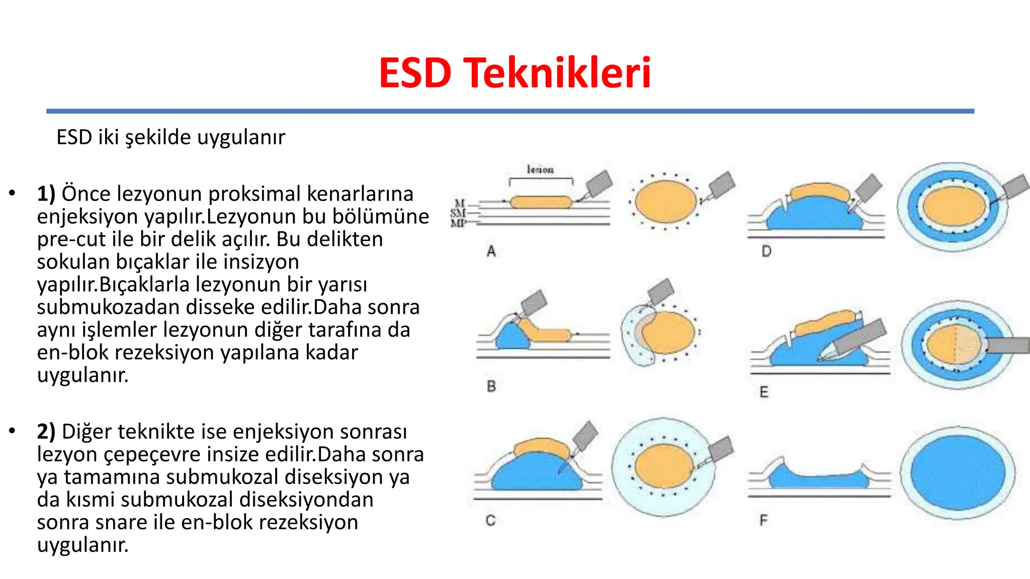 GÜLDEHAN İLAN ESD EMR POEM.pptx