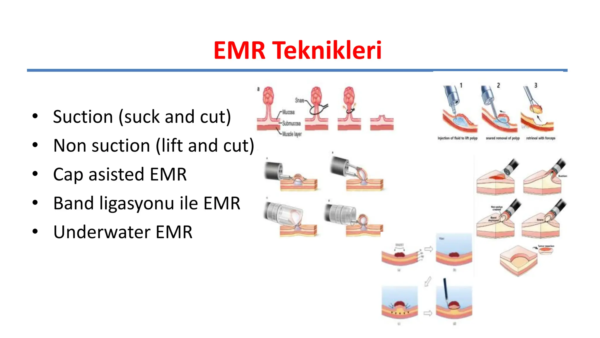 GÜLDEHAN İLAN ESD EMR POEM.pptx