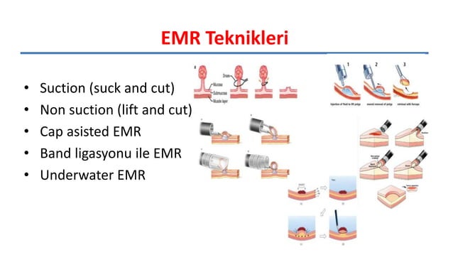 GÜLDEHAN İLAN ESD EMR POEM.pptx