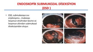 GÜLDEHAN İLAN ESD EMR POEM.pptx